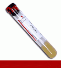 Thyroid Panel with TSH | Diagnostic Laboratory of Oklahoma