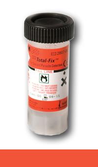 Ova and Parasites, Stool | Diagnostic Laboratory of Oklahoma